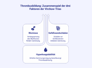 Thrombose Ursachen, Symptome & Therapie von Blutgerinnseln