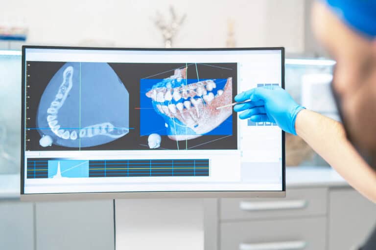 Dental-CT Anwendungsgebiete, Ablauf, Terminvergabe & FAQ