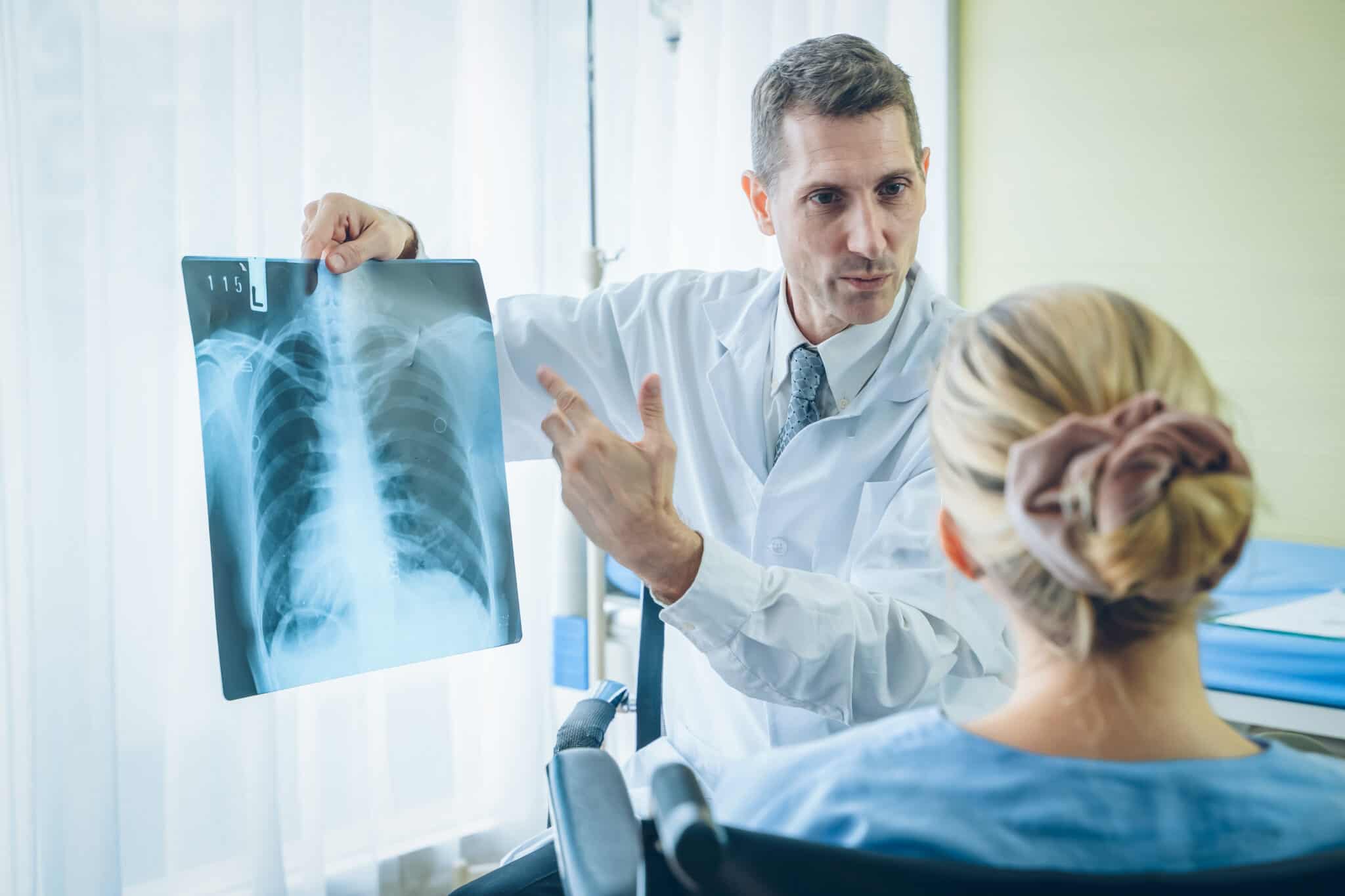 Lungenkrebs (Bronchialkarzinom) Symptome, Diagnose, Behandlung
