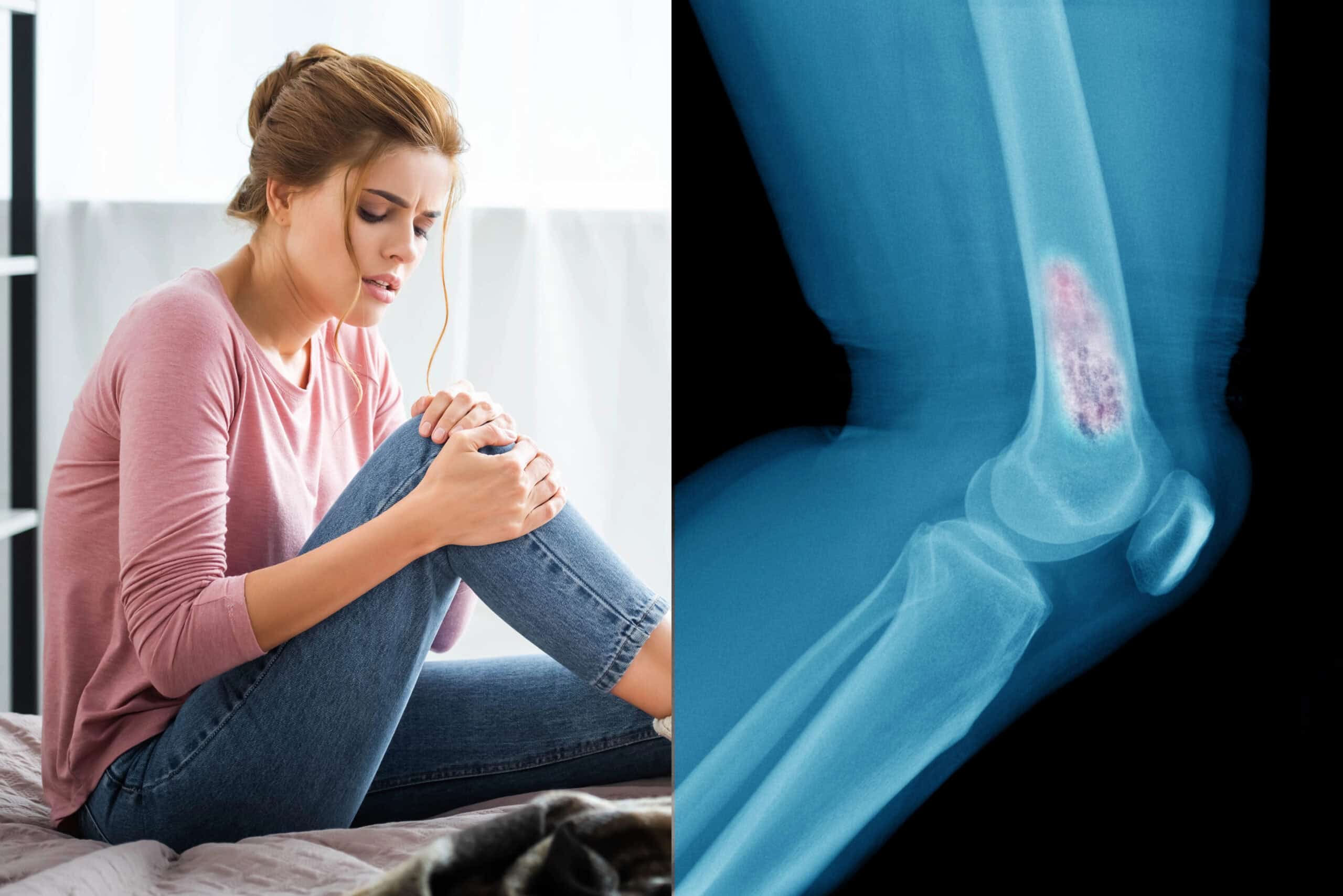 Knochenkrebs Ursachen, Symptome, Diagnostik & Behandlung