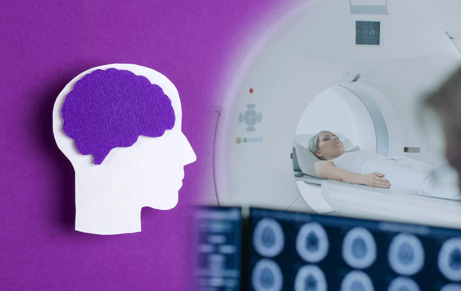 Schlechter MRT-Befund Wann erfolgt das Patientengespräch?