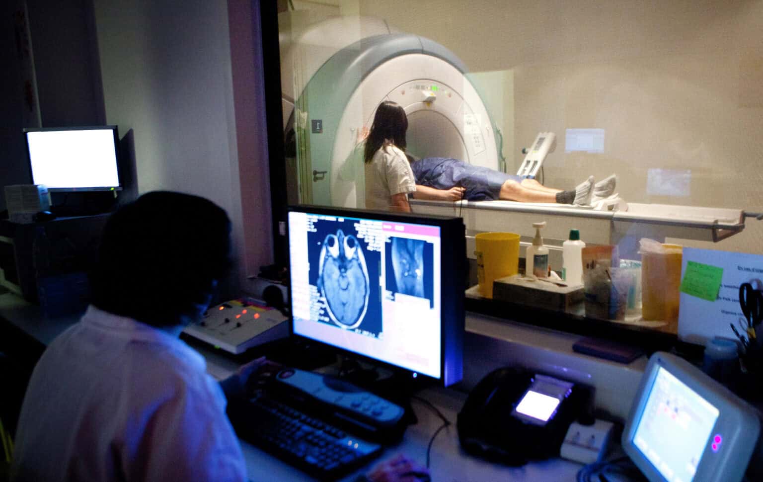 Schlechter MRT-Befund Wann erfolgt das Patientengespräch?