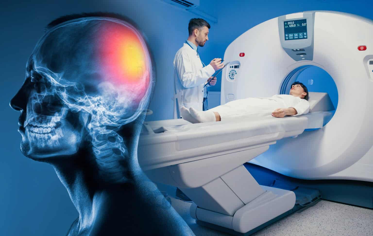 Schlechter MRT-Befund Wann erfolgt das Patientengespräch?